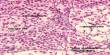 Reticular Connective Tissue - Assignment Point