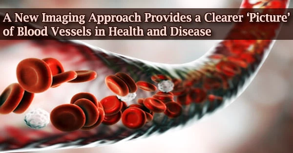 A New Imaging Approach Provides a Clearer ‘Picture’ of Blood Vessels in ...