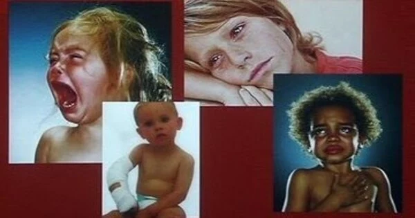 Pain in Children – Understanding and Treating - Assignment Point